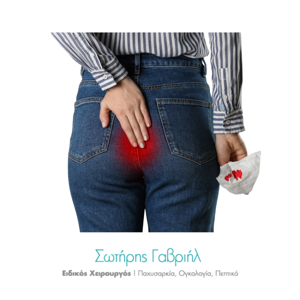 Αίμα στα κόπρανα – Τι σημαίνει: - Πότε να Ανησυχήσεις